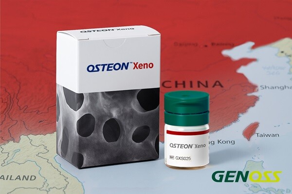 제노스, 이종골 이식재 ‘OSTEON Xeno’ 중국 의료기기 허가 획득…시장 진출 본격화