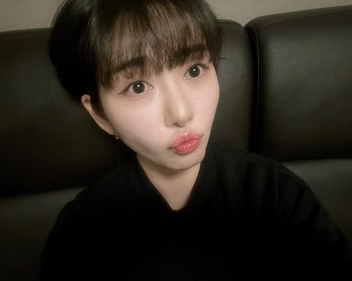 ‘팬들과의 약속 취소’…권민아 “회복 위해 노력 중” 진심 전해 | EPN